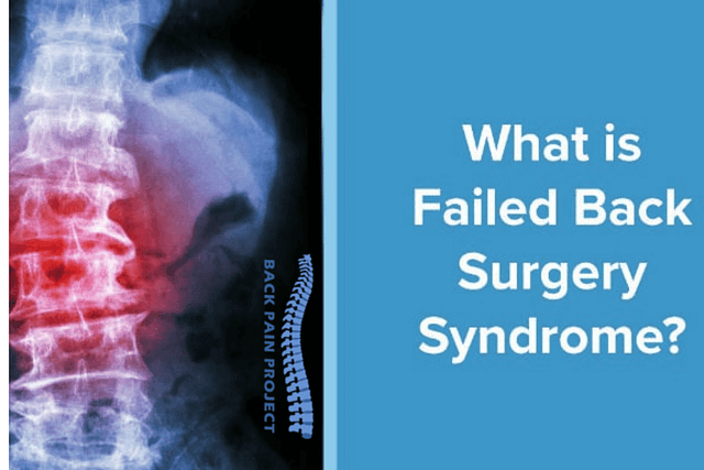 Failed Back Surgery-The Back Pain Project