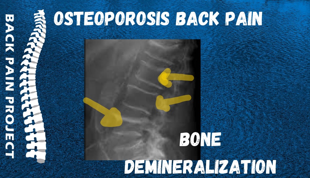 Osteoporosis back pain - The Back Pain Project